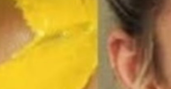 Turmeric eye compresses to reduce inflammation and irritation – Moms ...